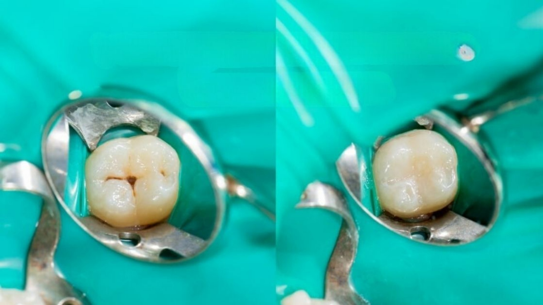 Confirmed by scientists—sheep wool regenerates your teeth and could put ...